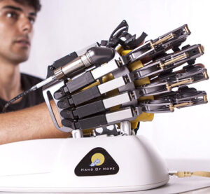 Hand of Hope - Exoskeleton Report