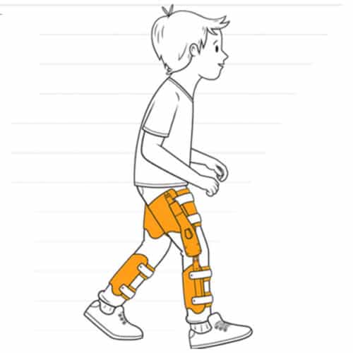 Agilik - Exoskeleton Report